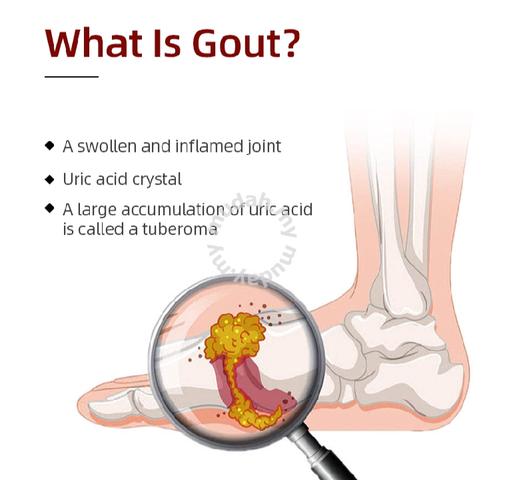Gout Liquid Spray 60ml - Health & Beauty for sale in Cheras, Kuala Lumpur